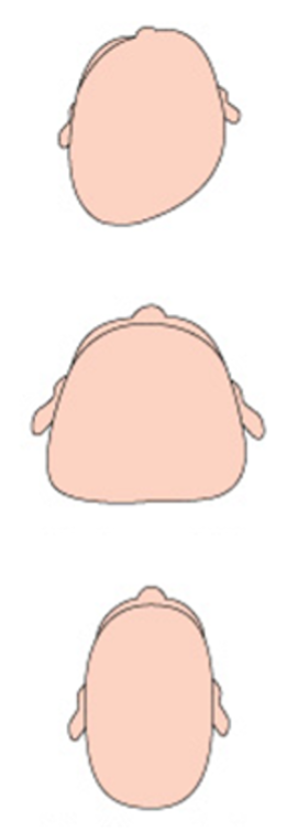 The Impact of Cranial-Facial Distortions on Childhood Development and ...